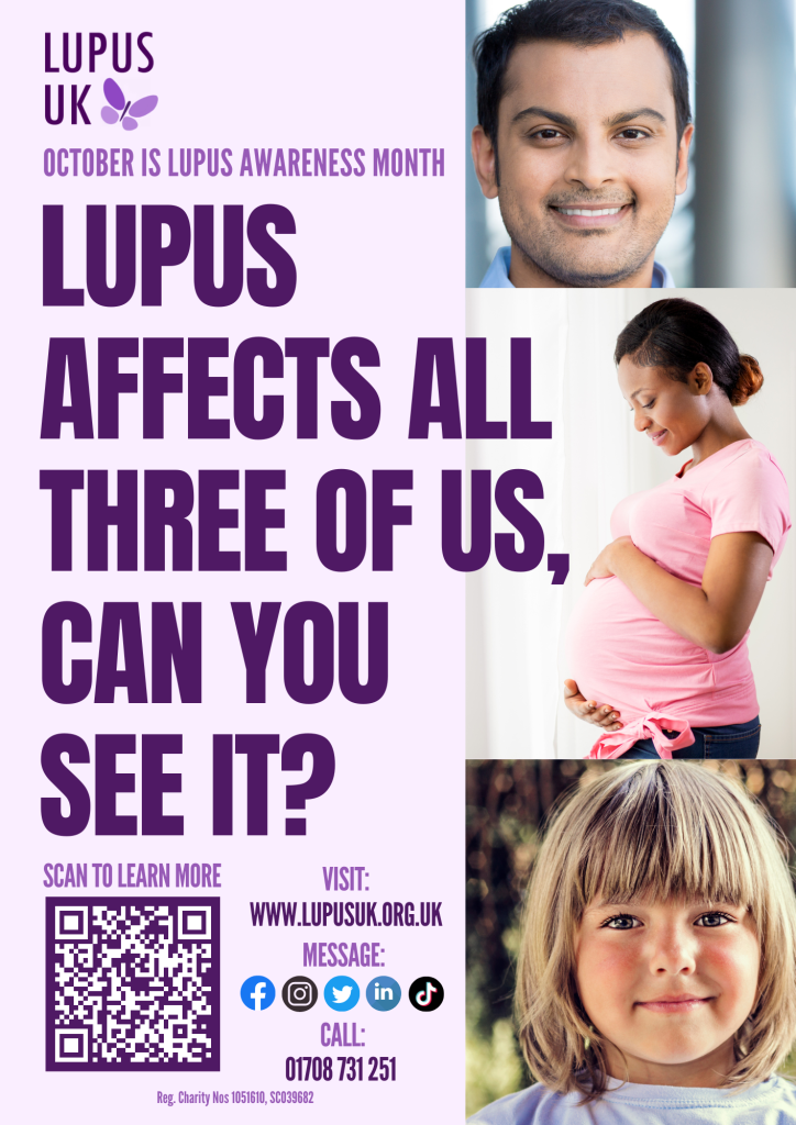 Living with Lupus: Understanding, managing, and seeking support